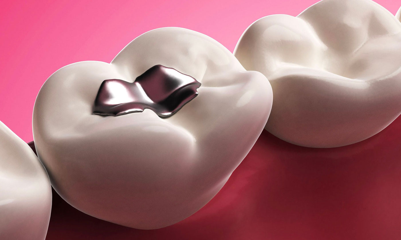 Root Canal Treatment in Gurgaon | RCT of Teeth in Gurgaon - Alveo Dental